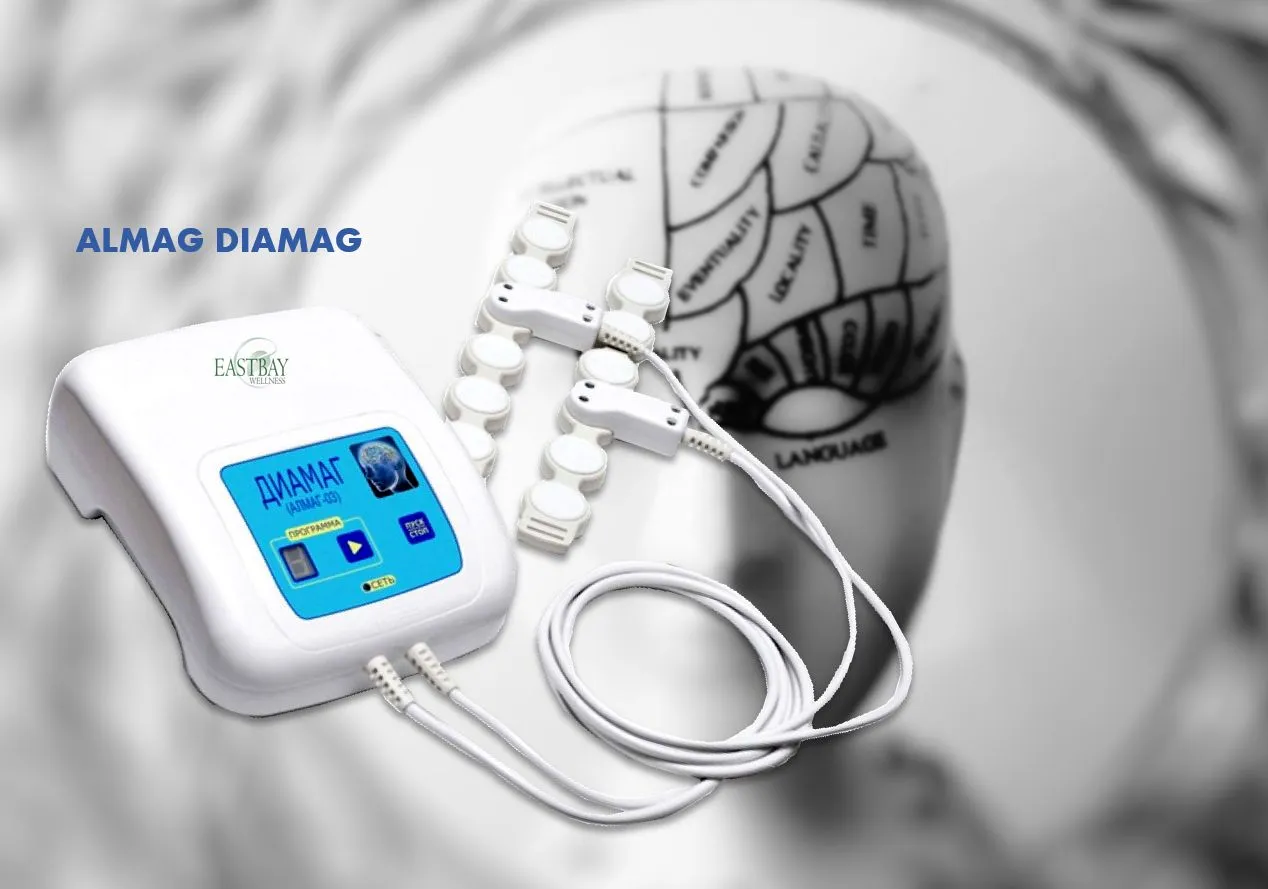 ALMAG DIAMAG rTMS • Eastbay Wellness